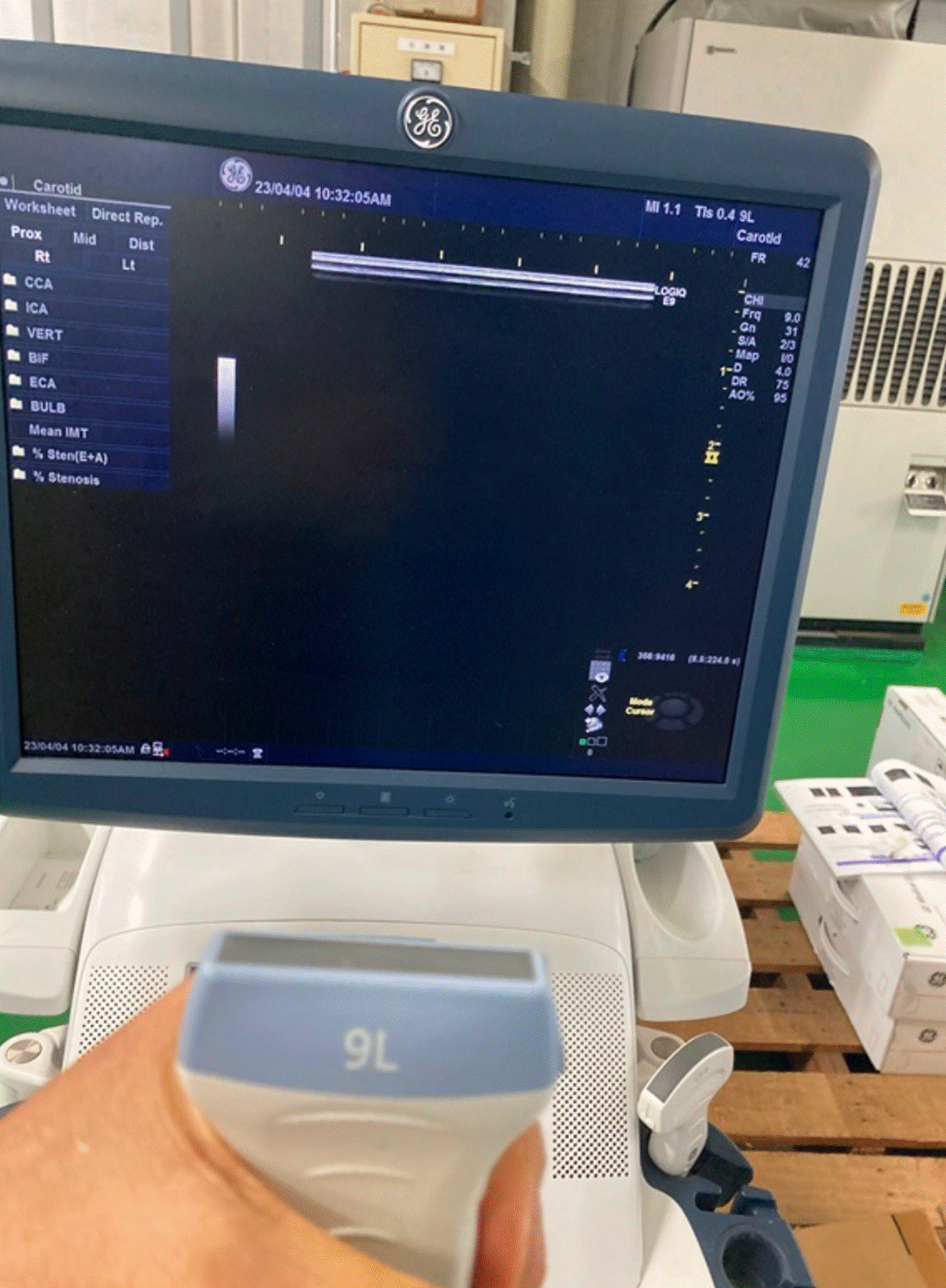 GE Logiq S8 Ultrasound | TEMPE