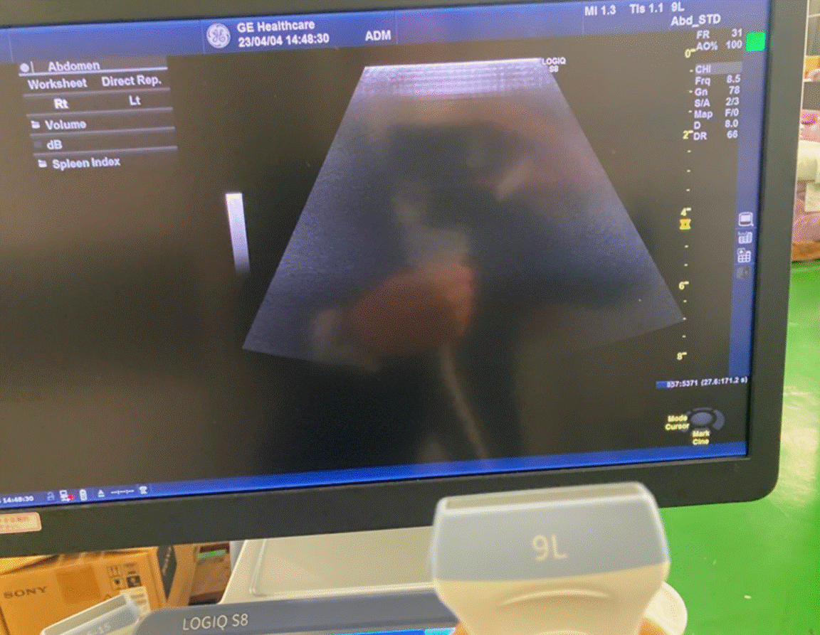 GE Logiq S8 Ultrasound | TEMPE