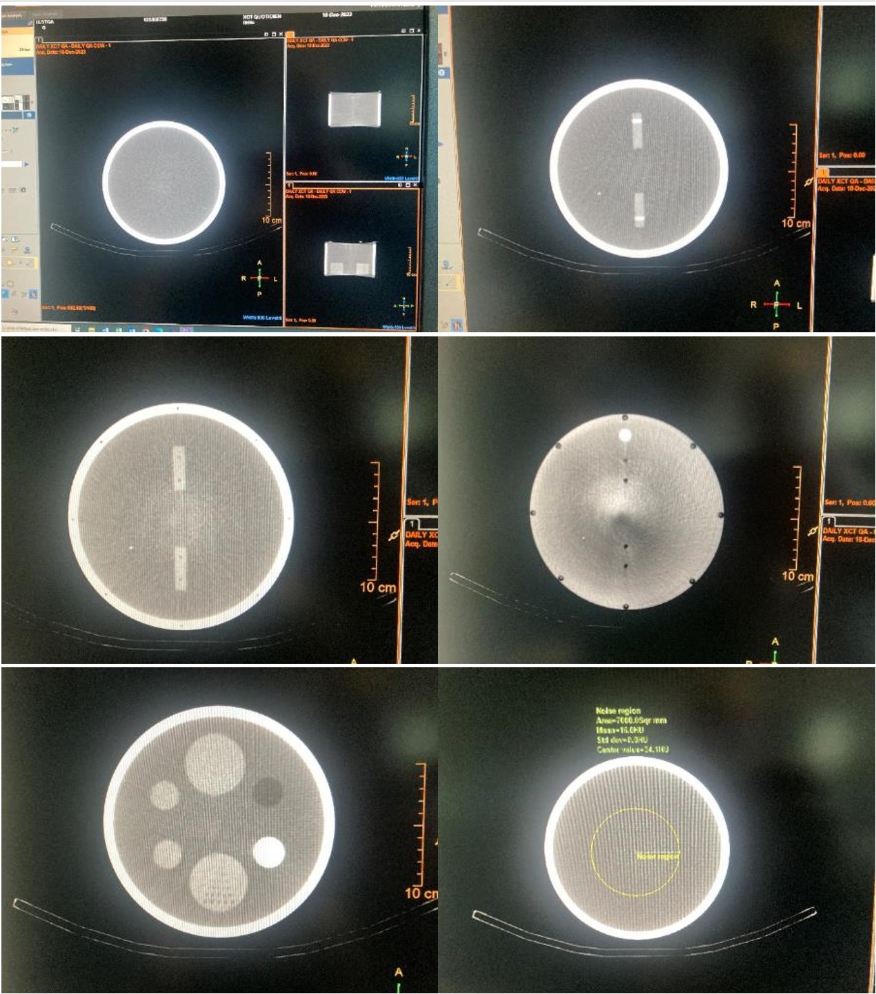 Philips SPECT/CT Brightview XCT | TEMPE