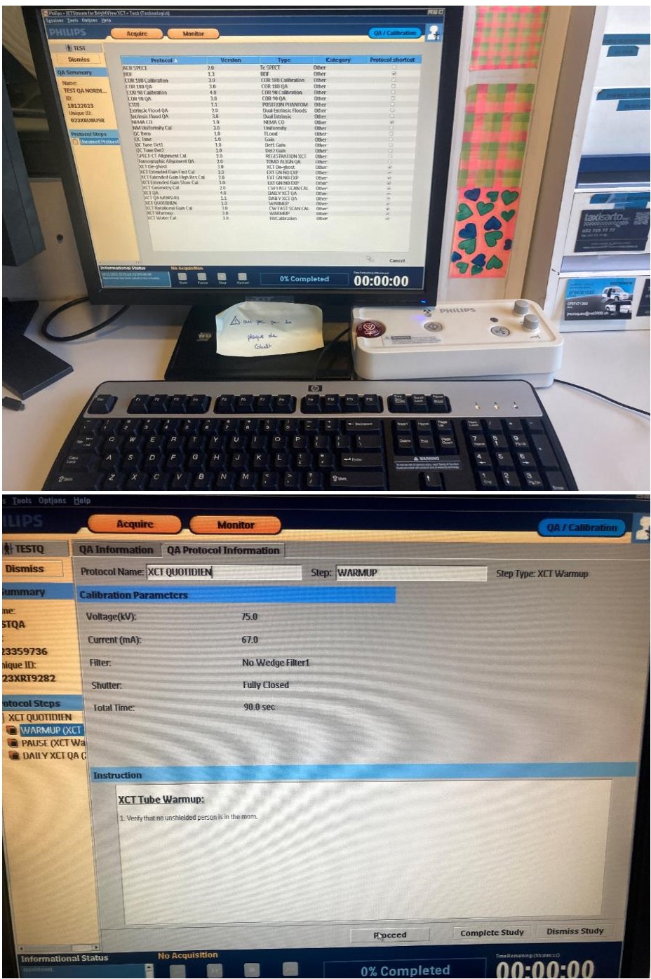 Philips SPECT/CT Brightview XCT | TEMPE
