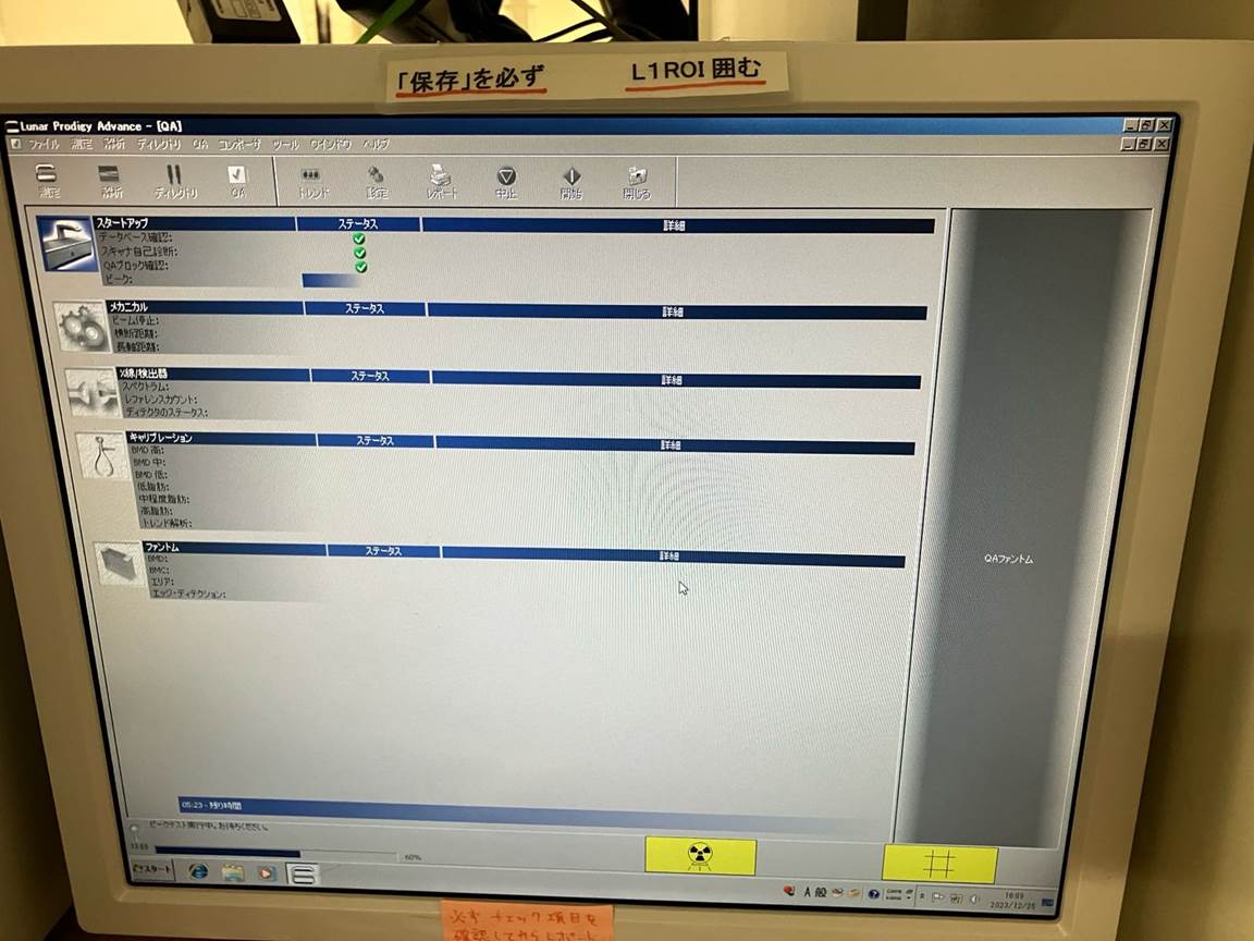 GE Bone Densitometer Lunar Prodigy Advance | TEMPE