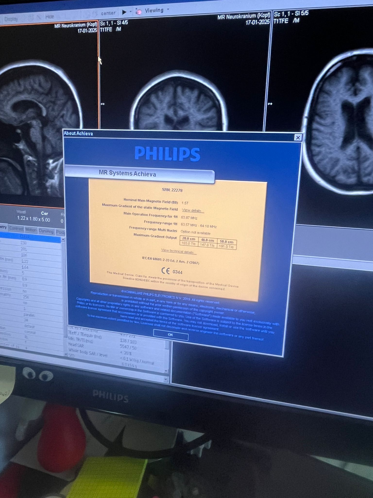 Philips MRI Achieva 1.5T (16ch) | TEMPE