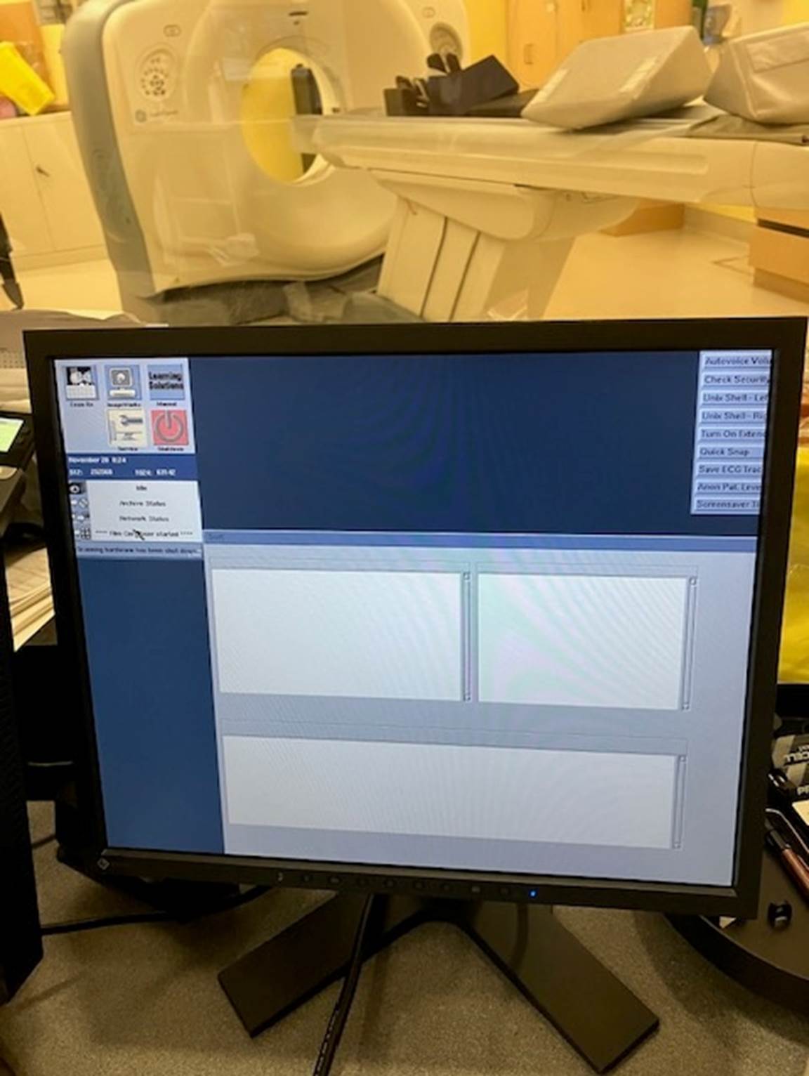 GE CT LightSpeed VCT 64-Slice | TEMPE