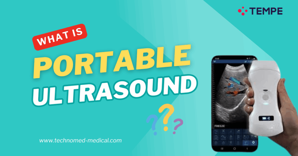 Portable Ultrasound Machines | TEMPE