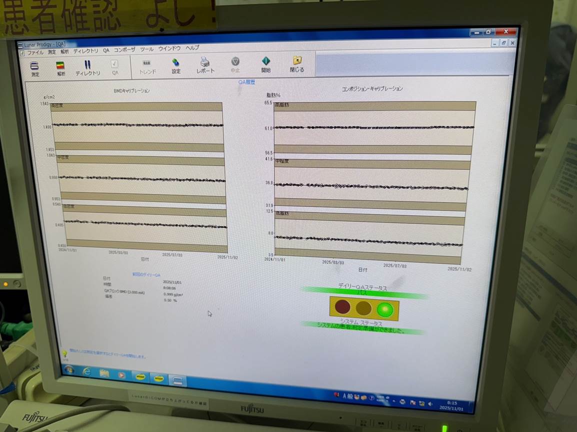 GE BMD Lunar Prodigy at Technomed | TEMPE